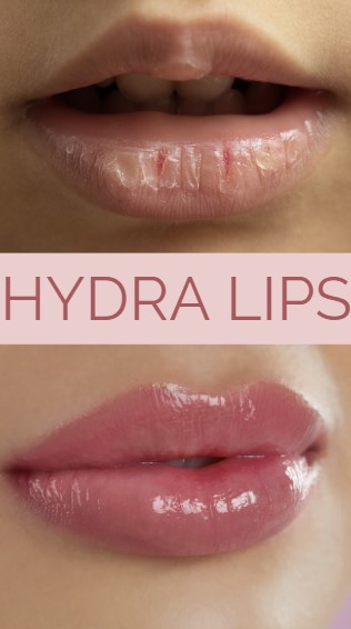 HYDRA LIPS - von Arx Cosmetics